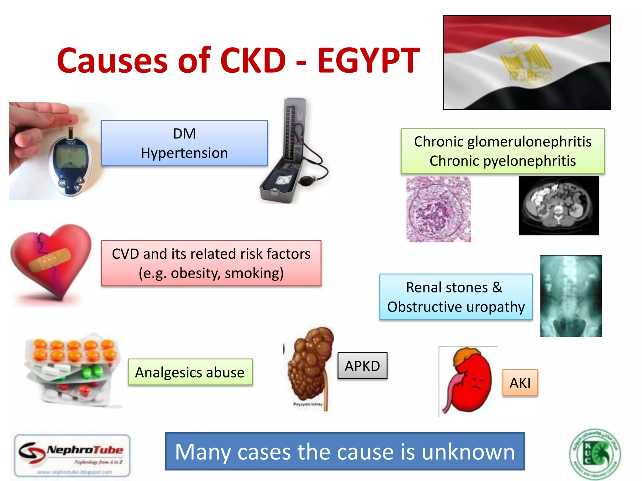 Chronic Kidney Disease (CKD) - At a Glance - Dr. Gawad | PPTX