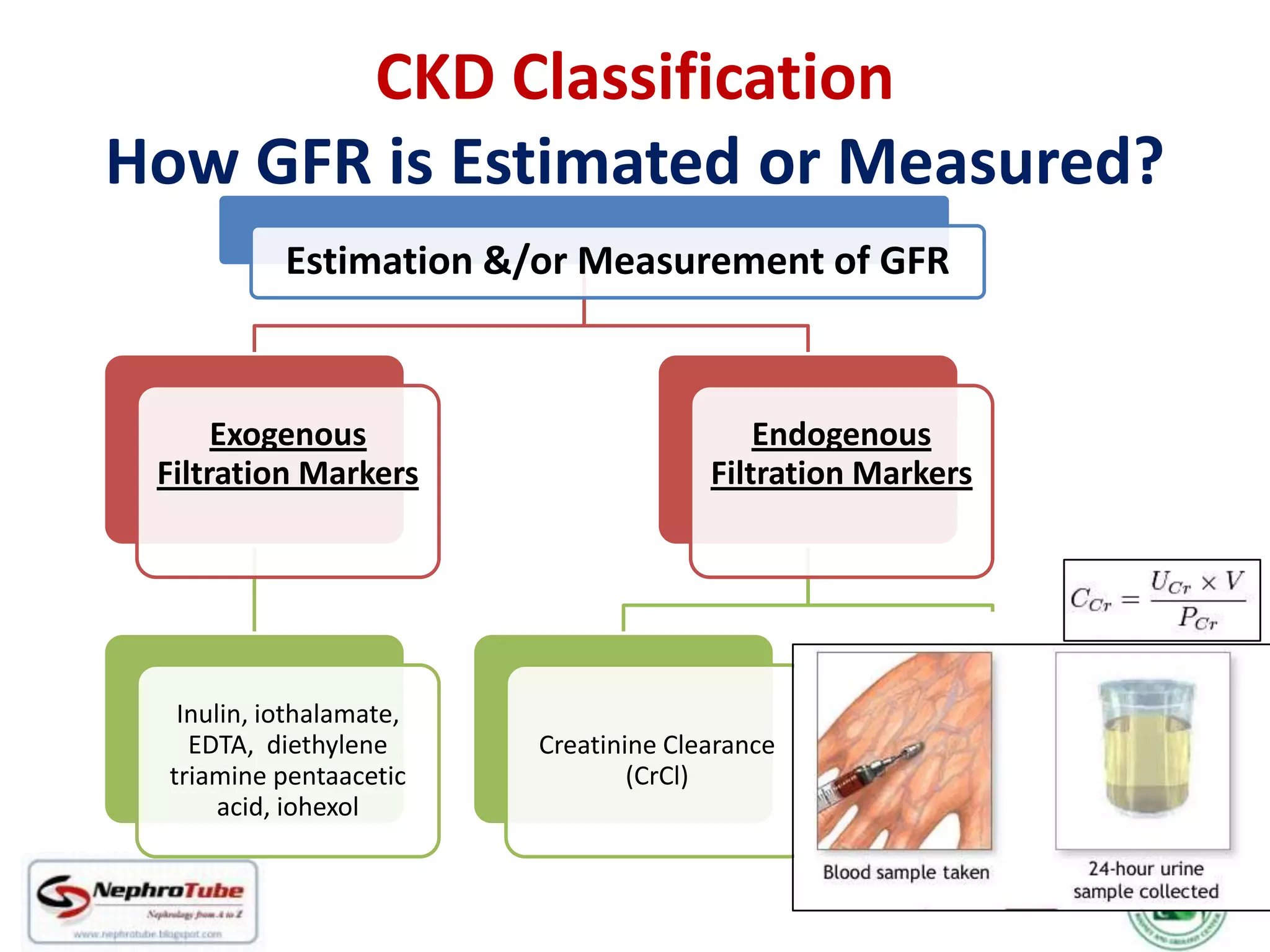 Chronic Kidney Disease (CKD) - At a Glance - Dr. Gawad | PPTX