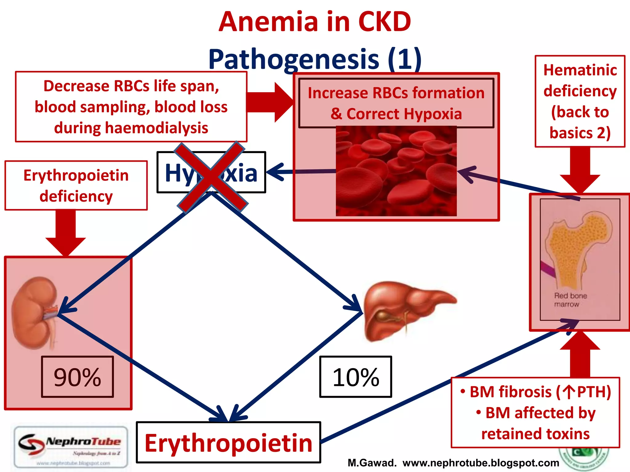 Chronic Kidney Disease (CKD) - At a Glance - Dr. Gawad | PPTX