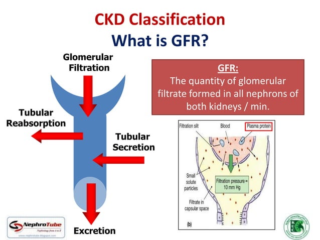 Chronic Kidney Disease (CKD) - At a Glance - Dr. Gawad | PPTX