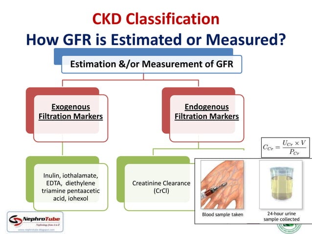 Chronic Kidney Disease (CKD) - At a Glance - Dr. Gawad | PPTX