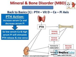 CKD MBD chronic kidney disease mineral bone disease Dr. Abdel Rahman ...