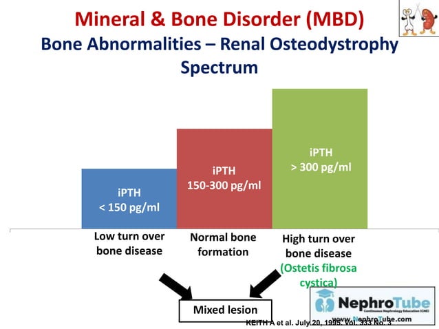 CKD Mineral Bone Disorder (CKD-MBD) - Dr. Gawad | PPTX