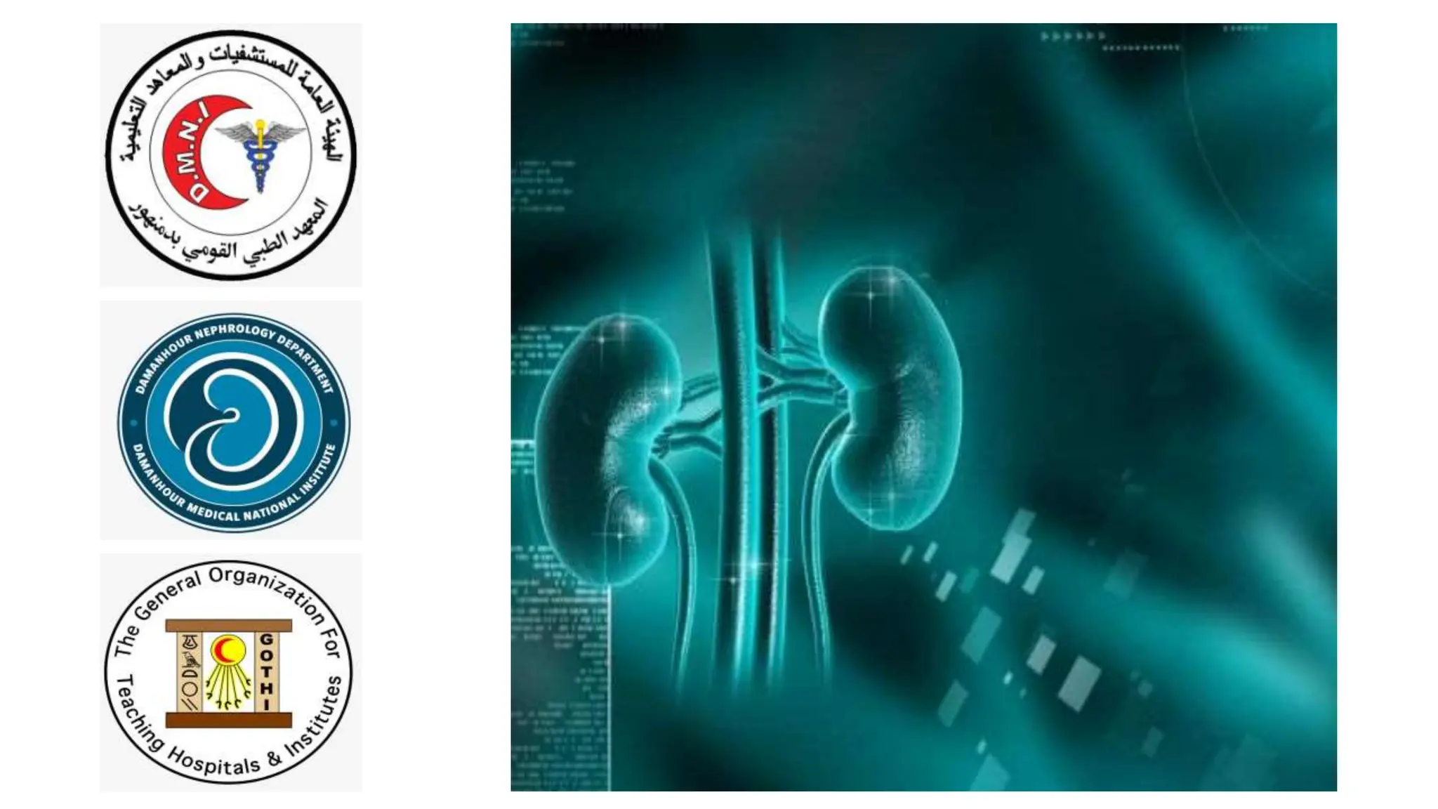 Chronic kidney disease mbd full version.pptx