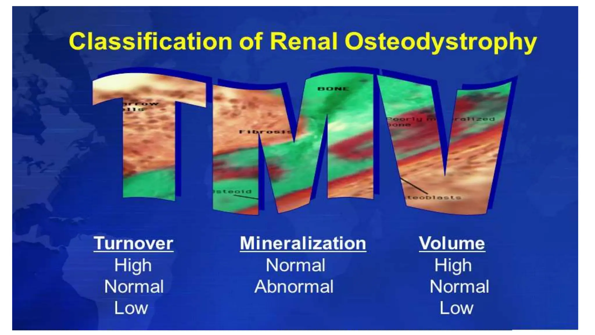 Chronic kidney disease mbd full version.pptx