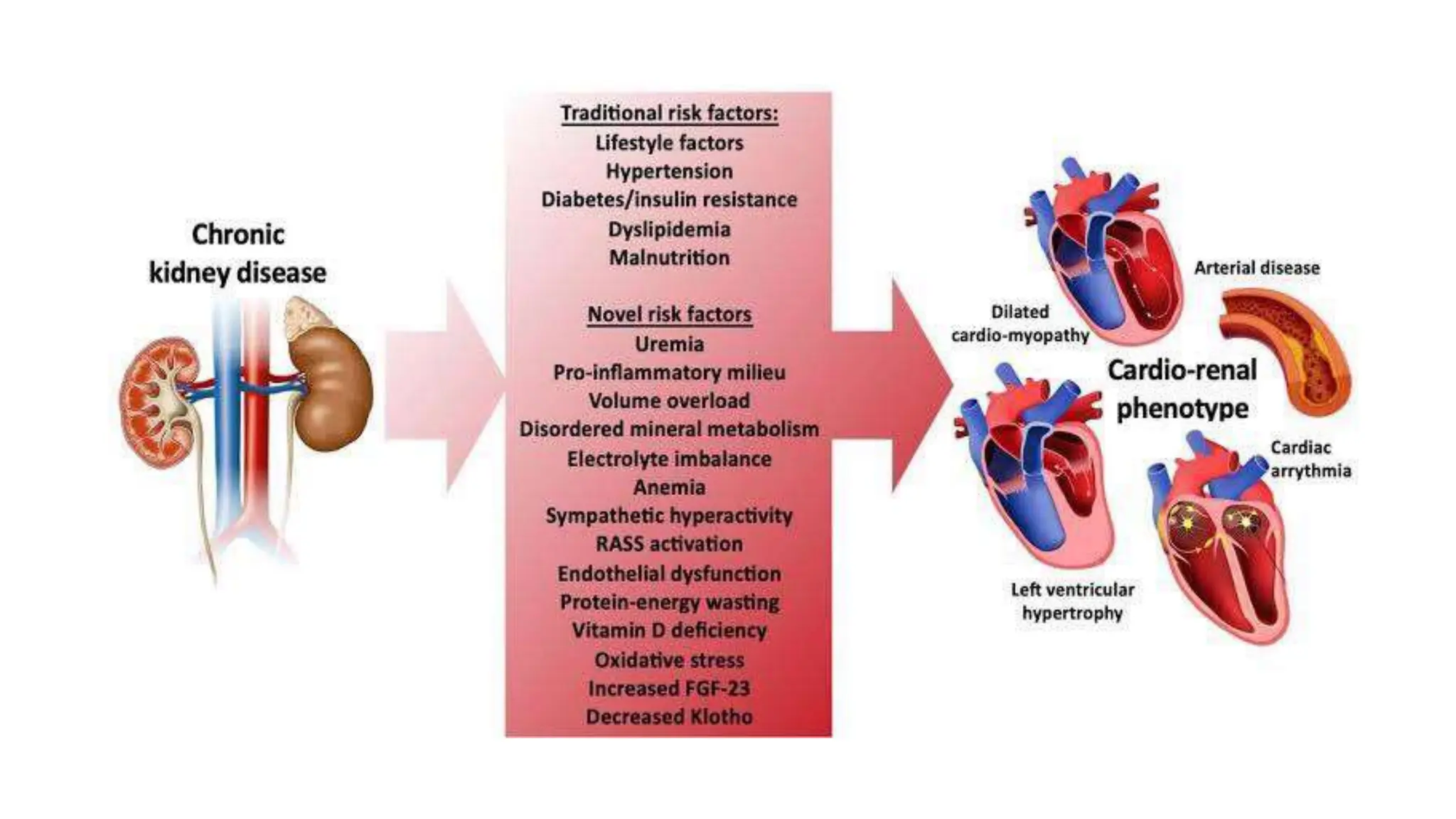 Chronic kidney disease mbd full version.pptx