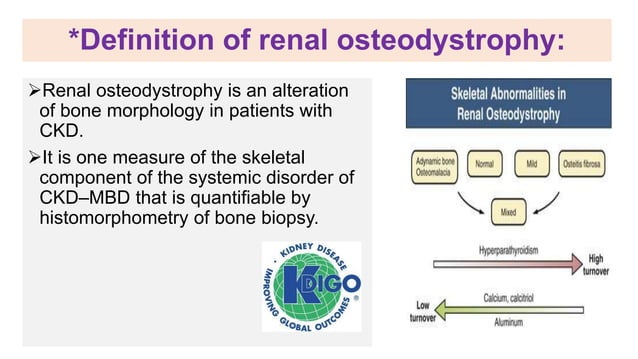 Chronic kidney disease mbd full version.pptx