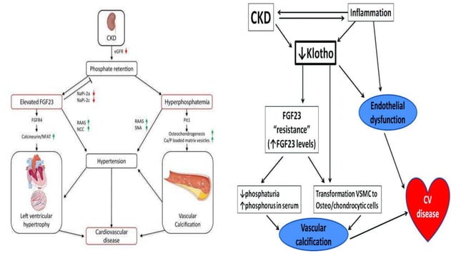 Chronic kidney disease mbd full version.pptx