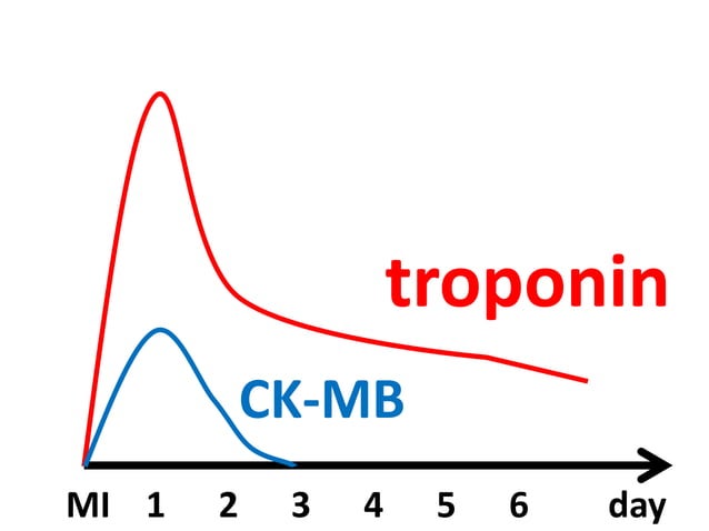CKMBの異常偽高値 | PPTX | Diseases and Conditions | Medical Health