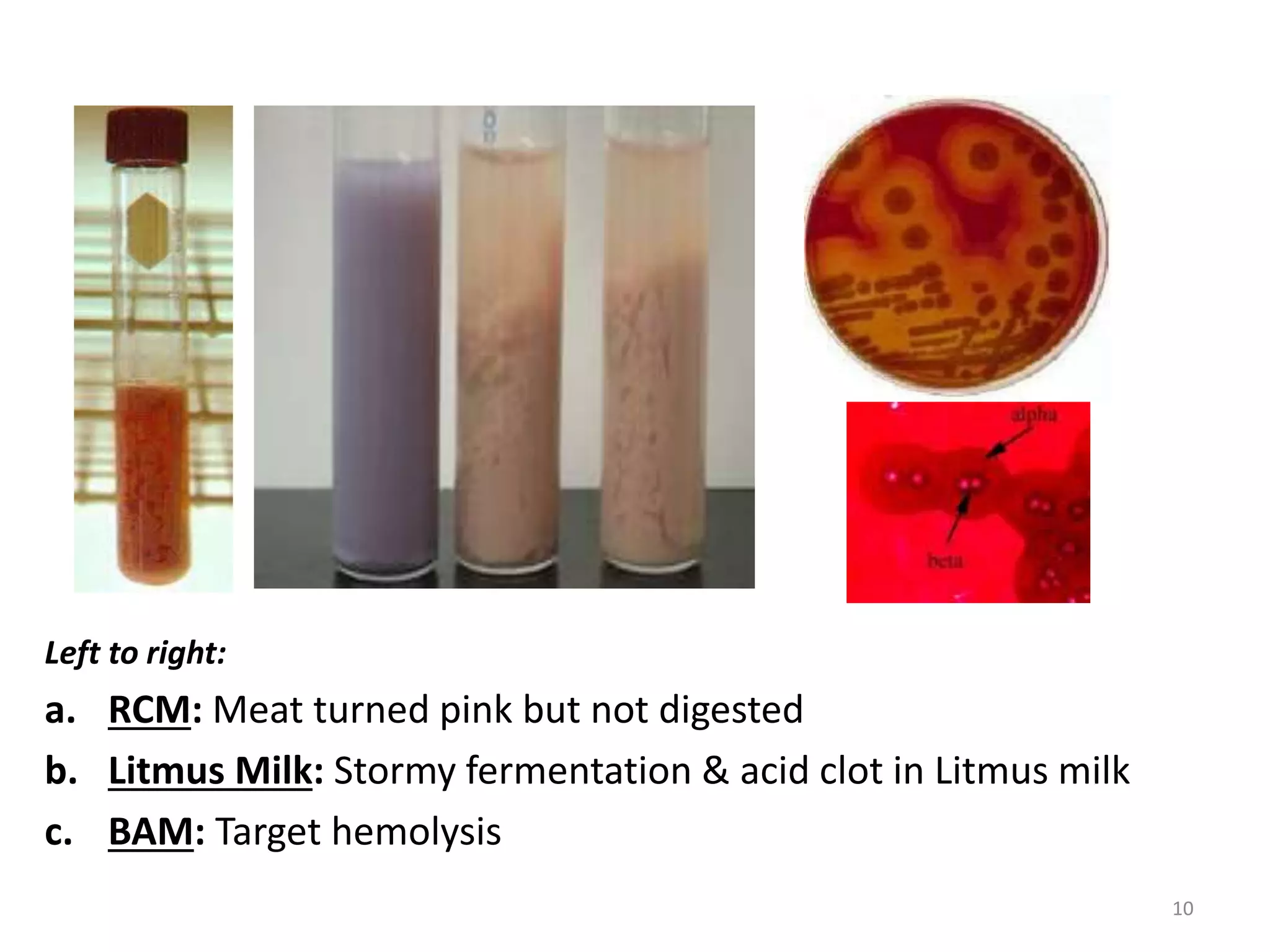 ClOSTRIDIUM perfringens | PPTX