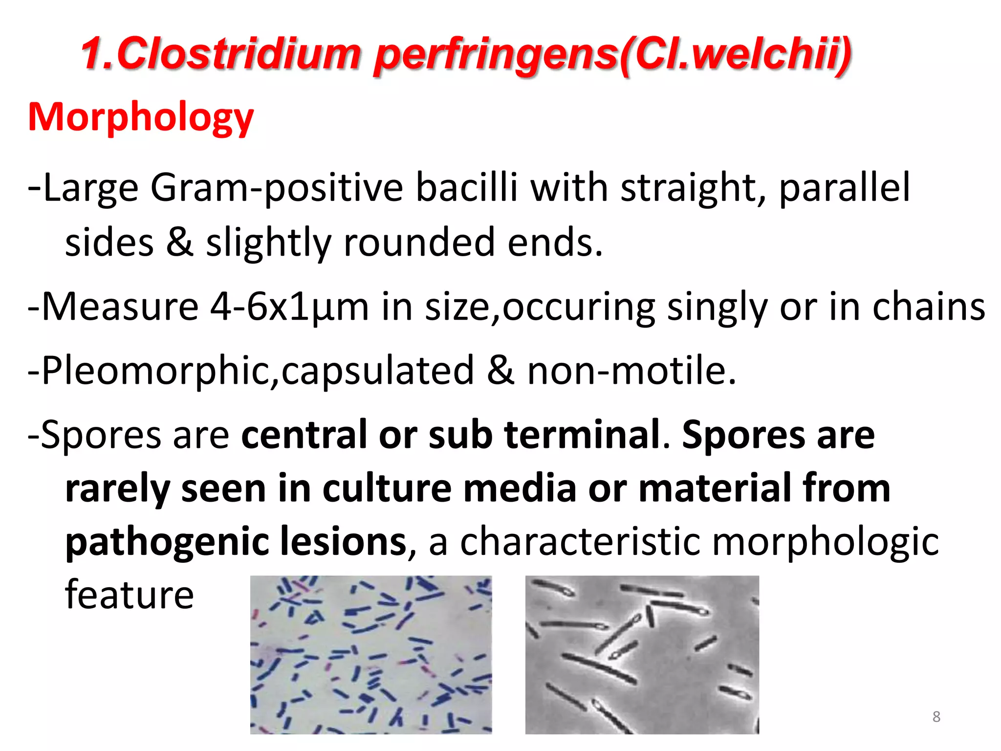 ClOSTRIDIUM perfringens | PPTX