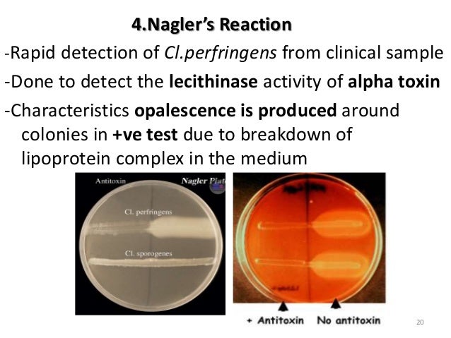 ClOSTRIDIUM perfringens