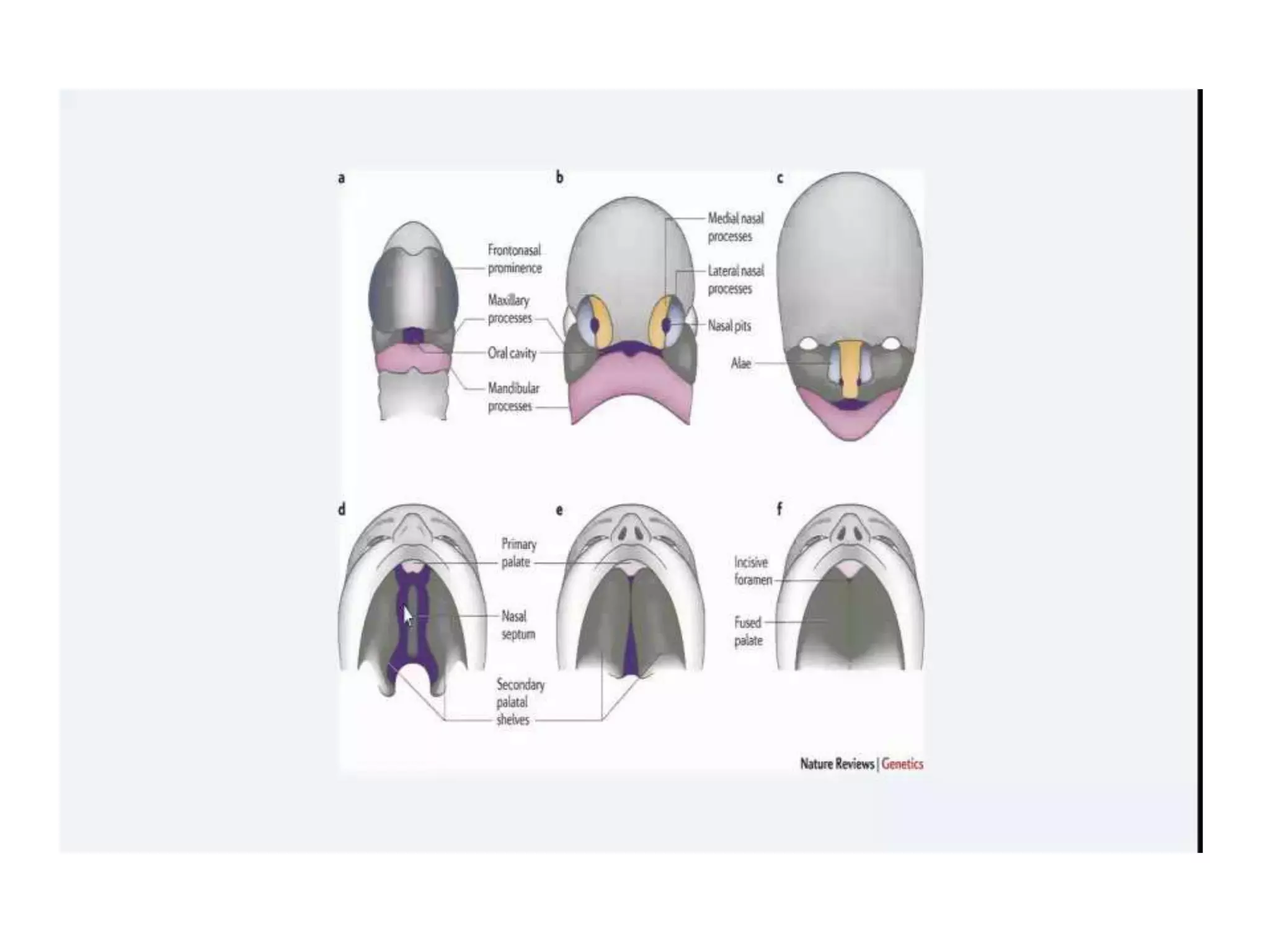 cleft lip and palate | PPTX | Ear, Nose and Throat Conditions | Diseases and Conditions