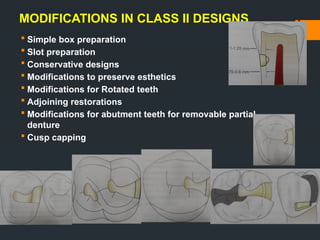 CL-II CAVITY MODIFICATIONS endodontics .pptx