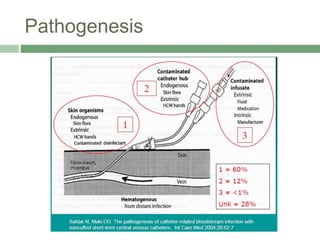CLABSI 2.ppt