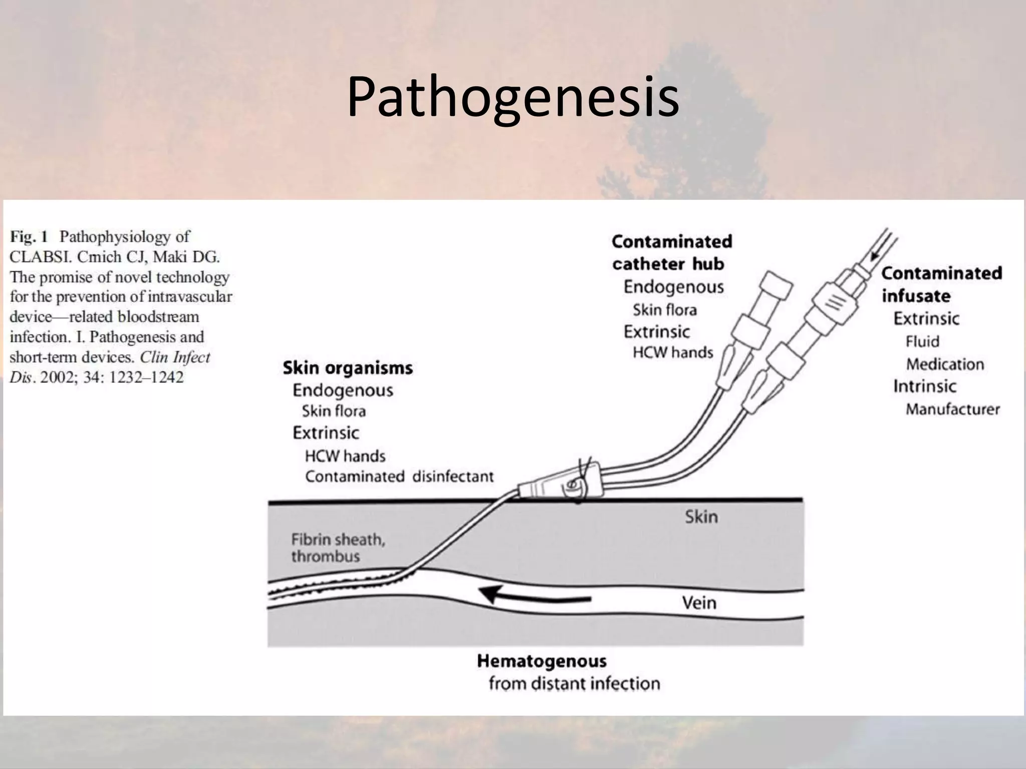 Central Line Associated Blood Stream Infections( CLABSI) | PPTX
