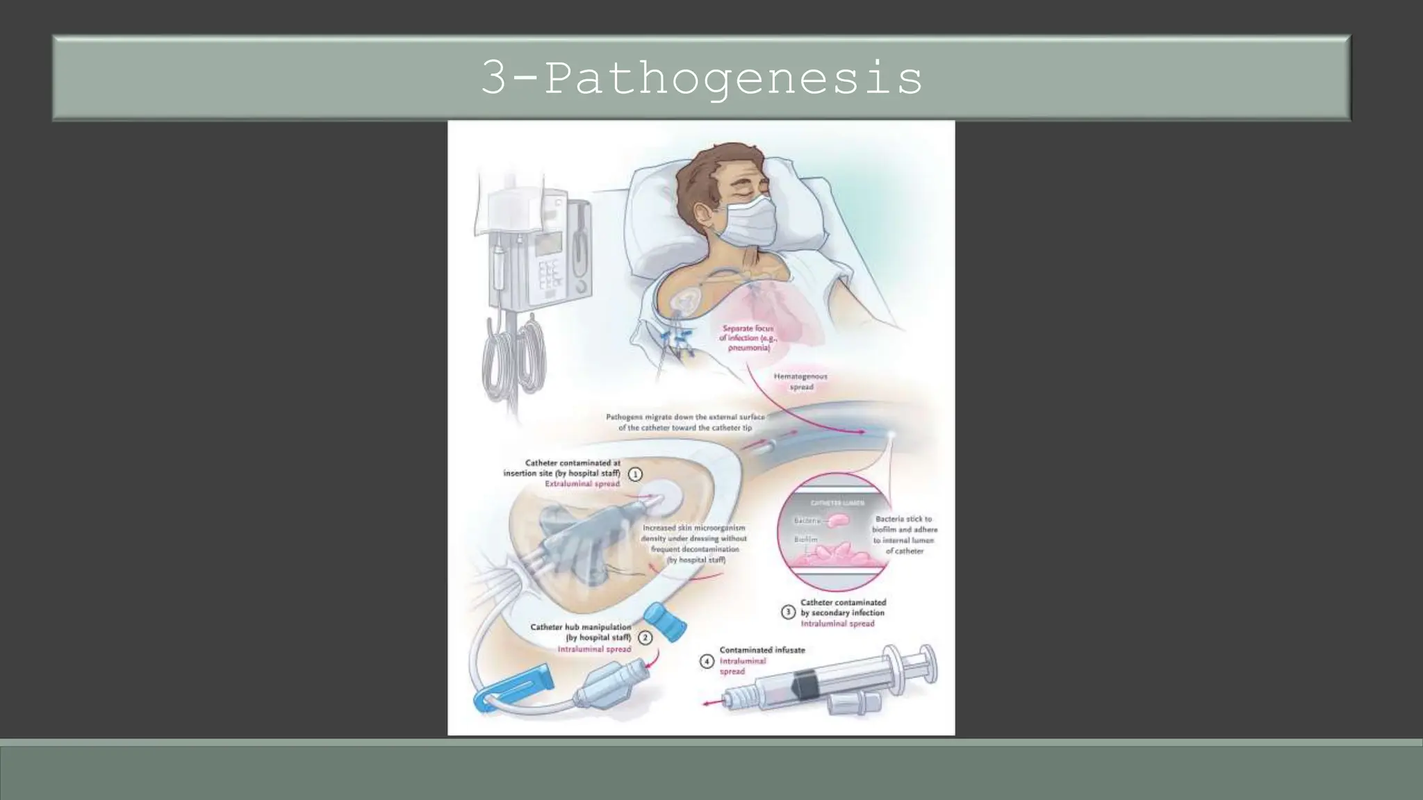 Prevention of Central Line–Associated Bloodstream Infections (CLABSI) prevention.pptx