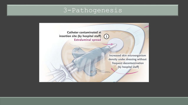 Prevention of Central Line–Associated Bloodstream Infections (CLABSI ...