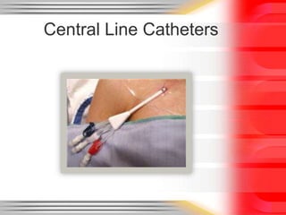 Avoiding Central Line Infections | PPTX