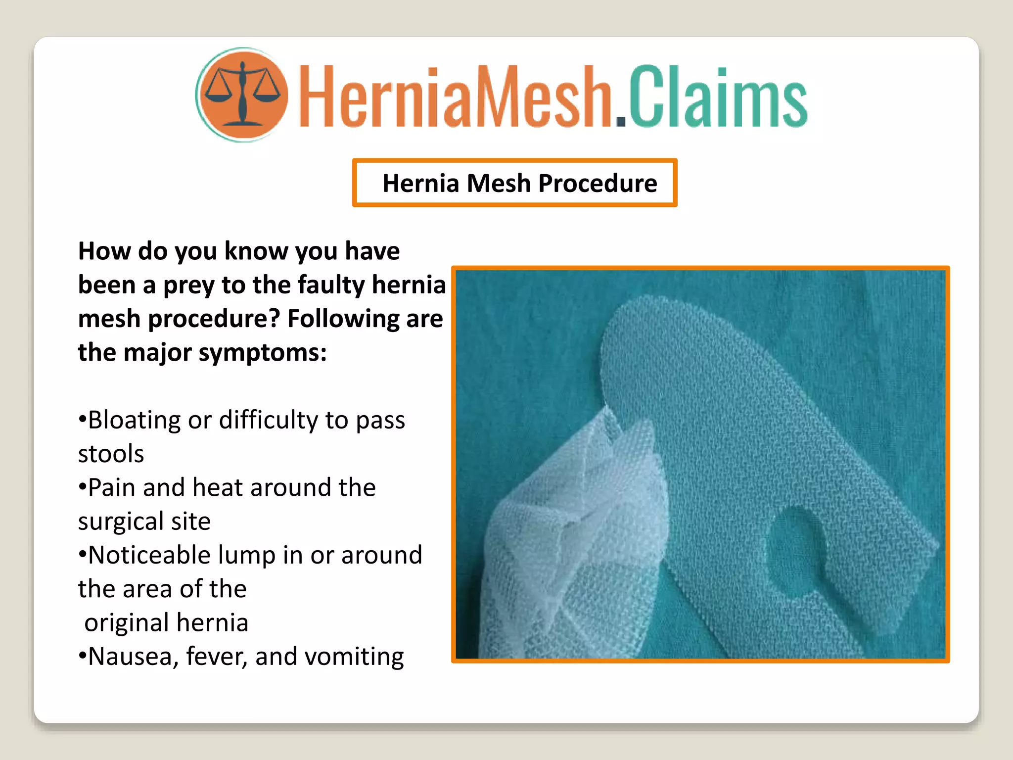 Claims For Serious Injuries & Complications | Hernia Mesh Claims | PPTX