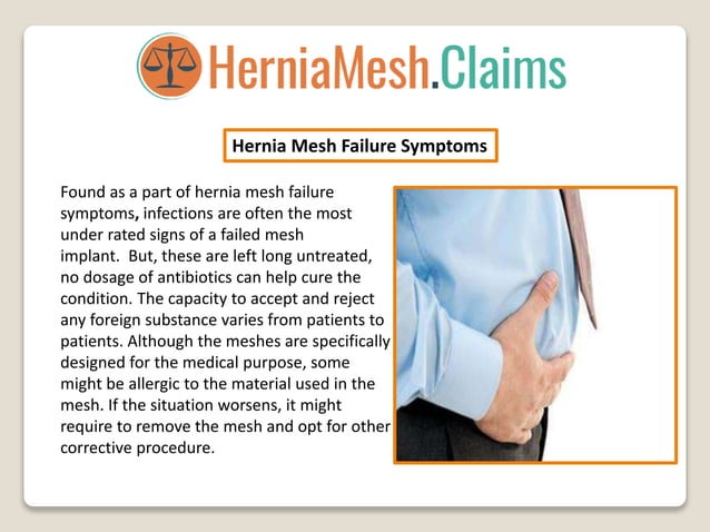 Claims For Serious Injuries & Complications | Hernia Mesh Claims | PPTX