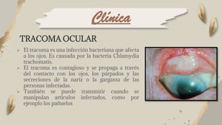 CLAMIDIA COMPLETO.pptx