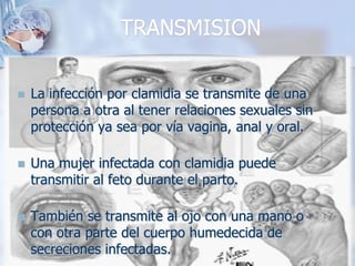 Clamidiasis | PPTX