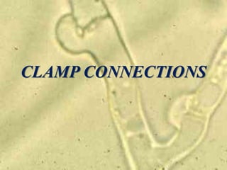 Clamp connectins | PPTX