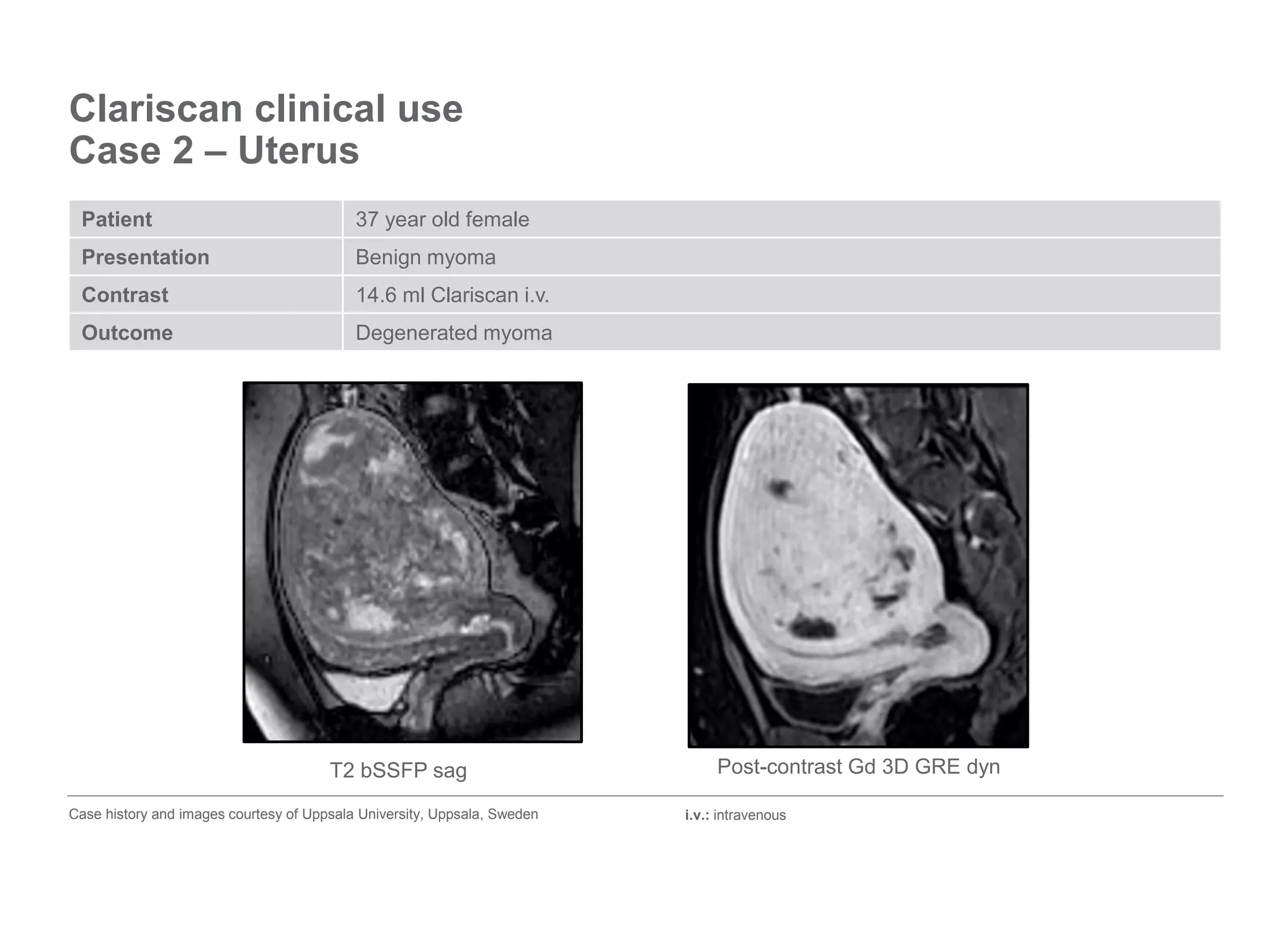 Clariscan in MR Imaging.pptx