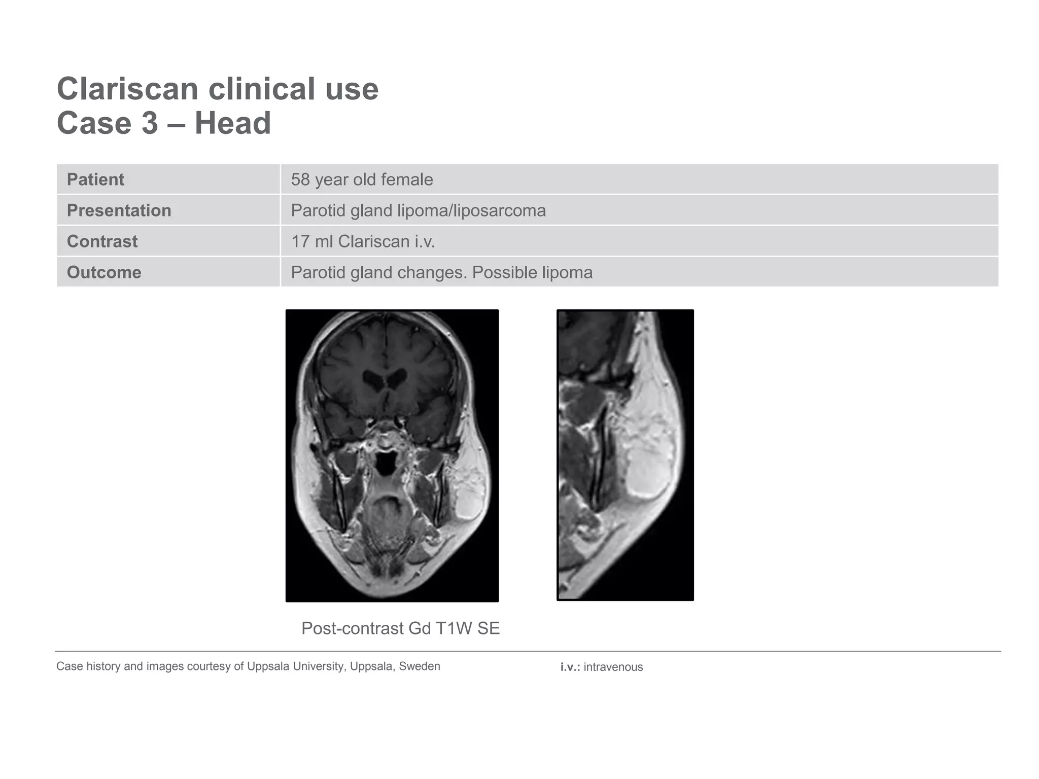 Clariscan in MR Imaging.pptx
