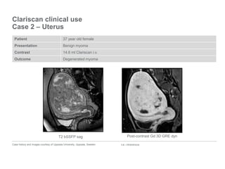 Clariscan in MR Imaging.pptx