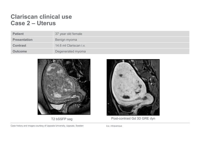 Clariscan in MR Imaging.pptx