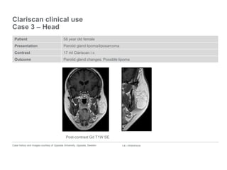 Clariscan in MR Imaging.pptx