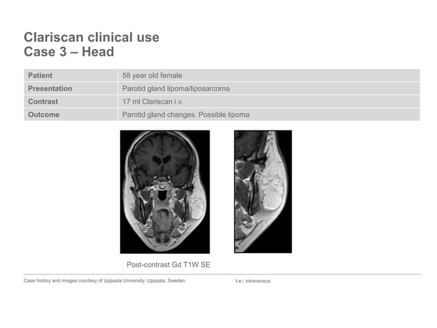Clariscan in MR Imaging.pptx