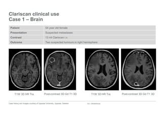 Clariscan in MR Imaging.pptx