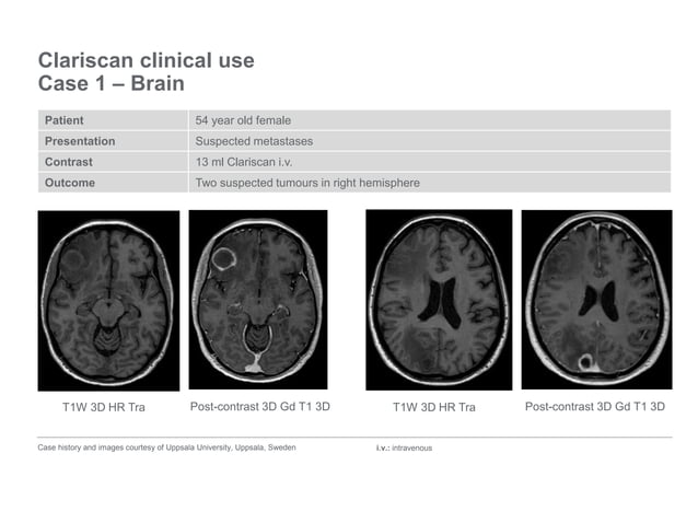 Clariscan in MR Imaging.pptx | Medical Tests | Medical Health