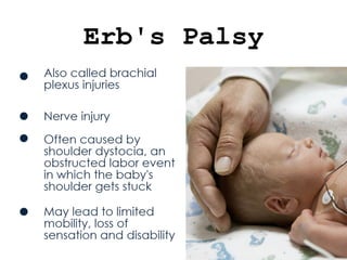 Birth Injury: Claims and Compensation | PPT