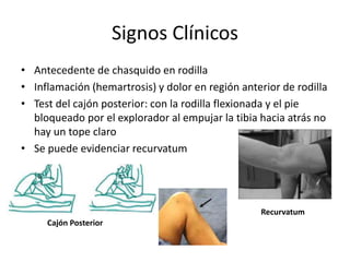 Clase 14.-lesiones-ligamentarias-de-la-rodilla | PPTX