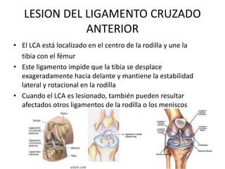 Clase 14.-lesiones-ligamentarias-de-la-rodilla | PPTX