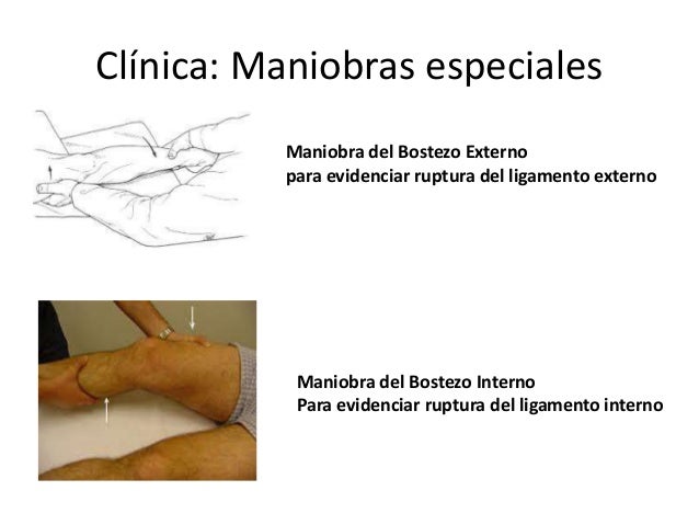 Clase 14.-lesiones-ligamentarias-de-la-rodilla