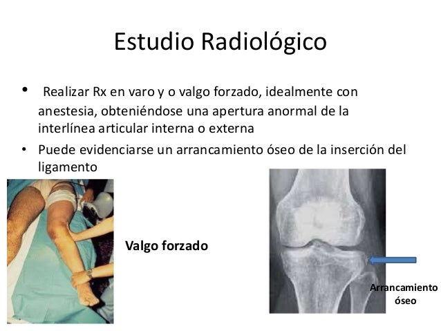 Clase 14.-lesiones-ligamentarias-de-la-rodilla