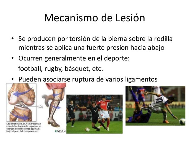 Clase 14.-lesiones-ligamentarias-de-la-rodilla