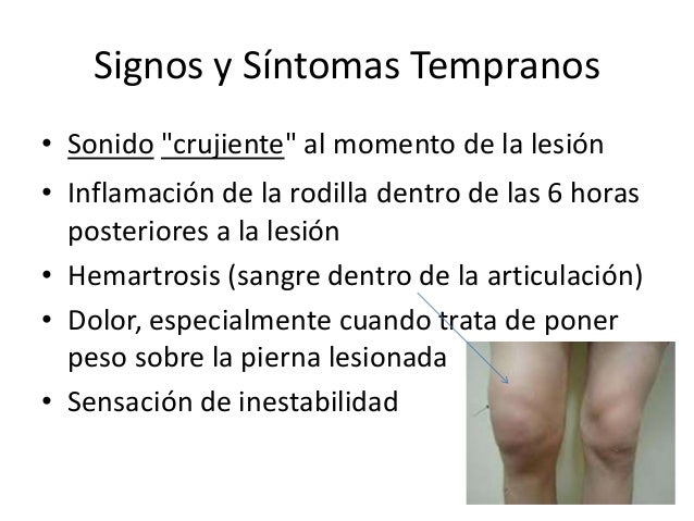 Clase 14.-lesiones-ligamentarias-de-la-rodilla