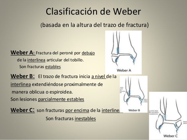 Clase 15.-fracturas-del-tobillo-y-pie