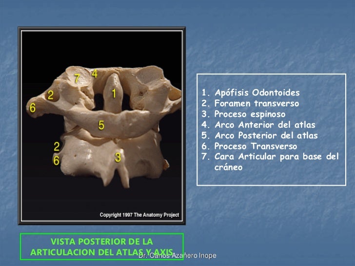 Clase 4 1 Columna Cervical