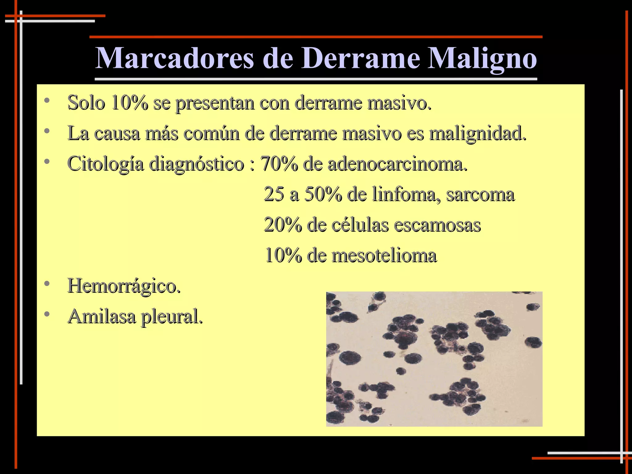 Semiología del Derrame Pleural | PPT
