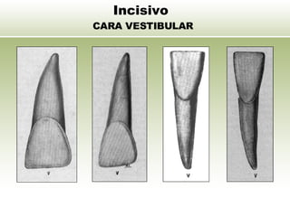 Clase De Incisivo | PPT