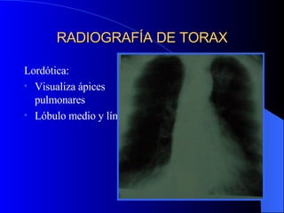 Generalidades de la Radiología De Tórax | PPT