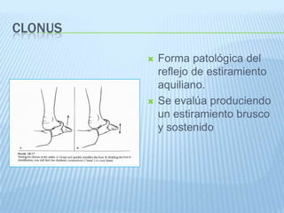 Clase 09 ex fisico neurologico 2011 | PPTX