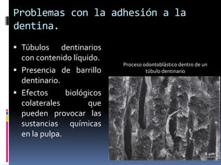 Adhesión a la estructura dentaria | PPTX